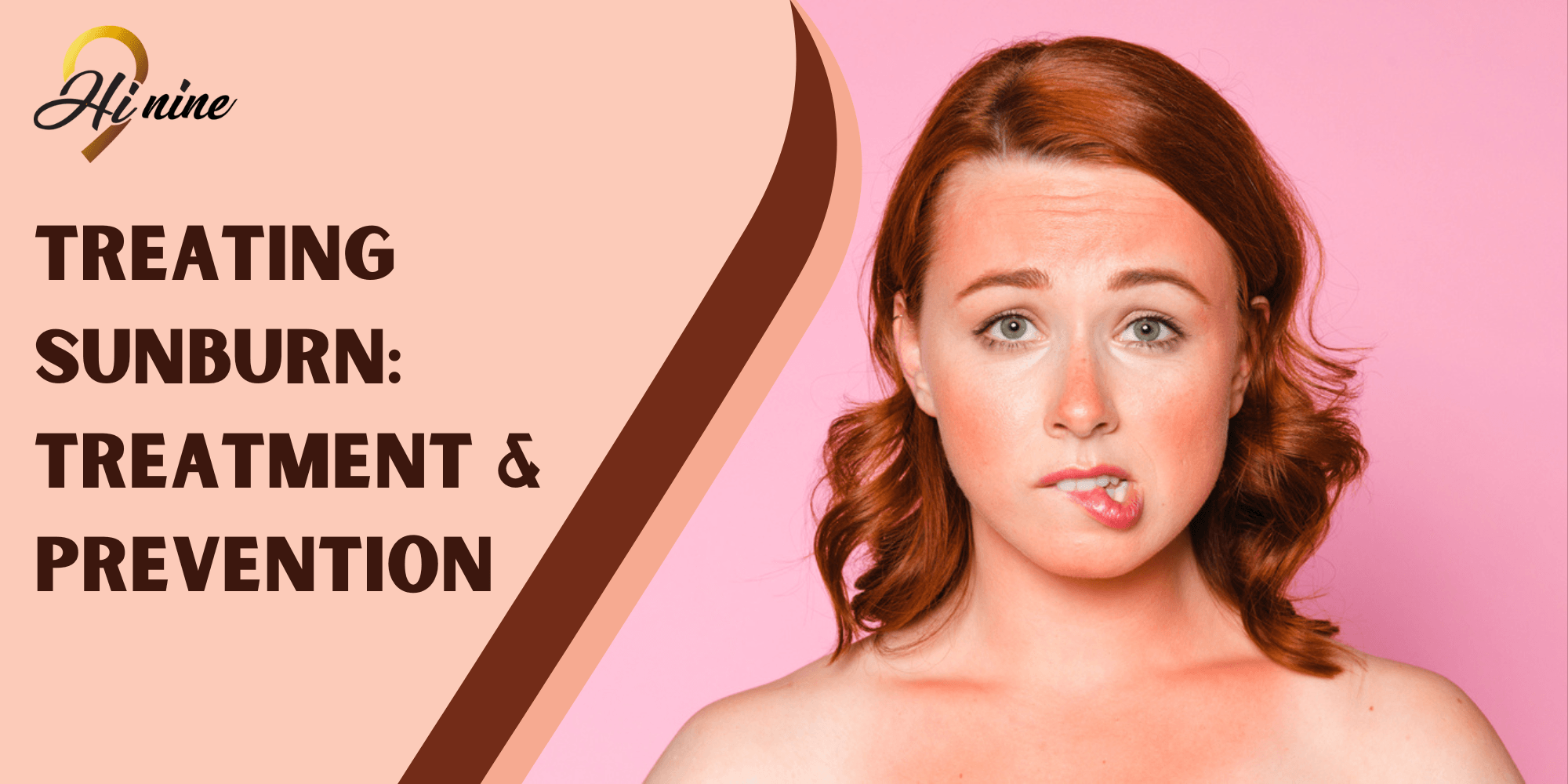 Treating Sunburn Treatment And Prevention Hi9 Blogs Myhi9