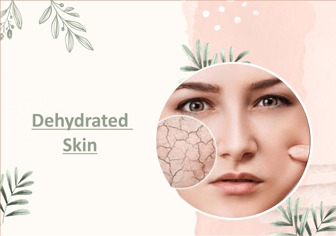 Dehydrated Skin – Myhi9